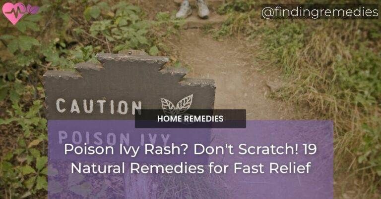 Poison Ivy Rash? Don't Scratch! 19 Natural Remedies for Fast Relief ...