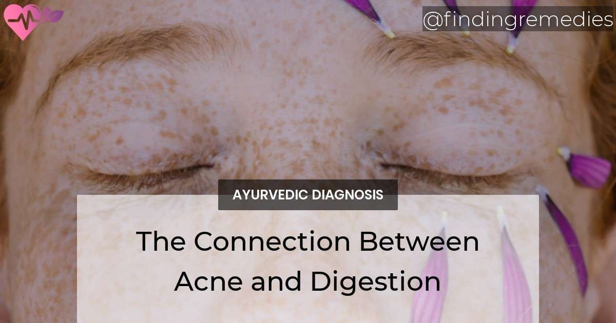 The Connection Between Acne and Digestion: Understanding the Root Cause
