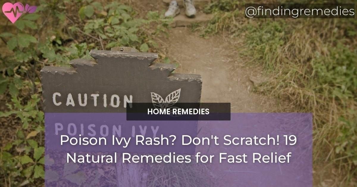 Poison Ivy Rash? Don't Scratch! 19 Natural Remedies for Fast Relief ...